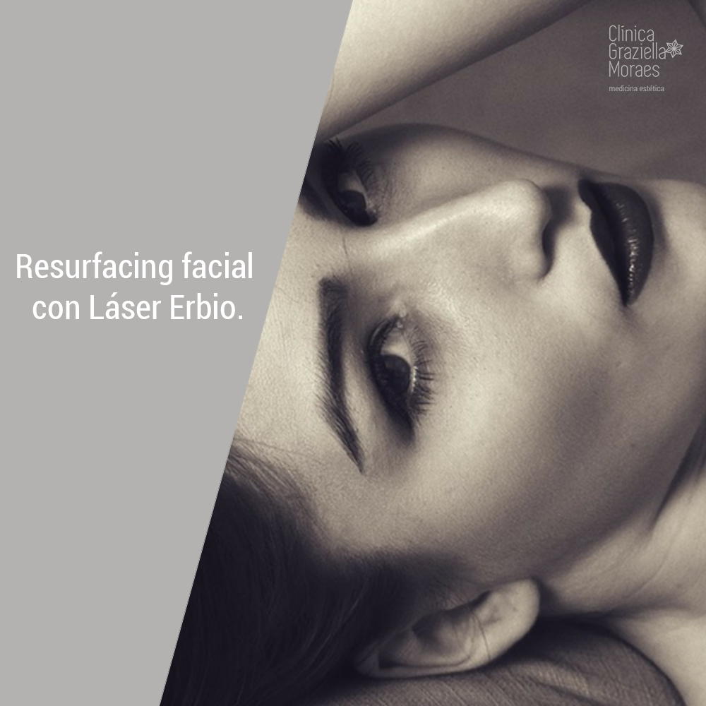 Beneficios del Resurfacing facial con Láser Erbio para lucir 10 años ...
